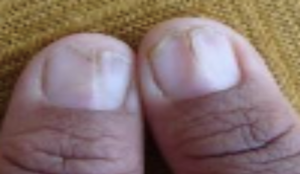 Doigt de porte - IECEM